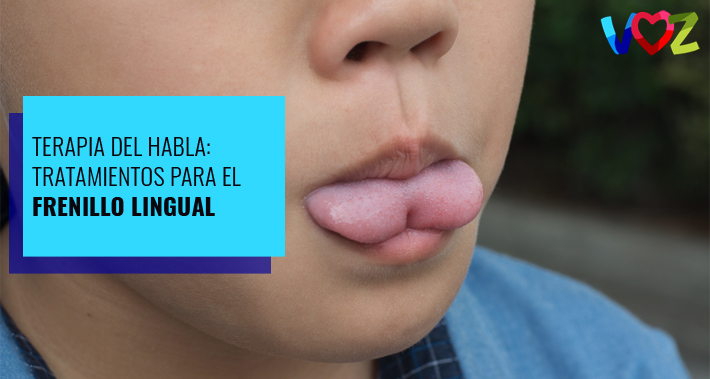 Terapia del habla: Tratamientos para el frenillo lingual | El Instituto ...